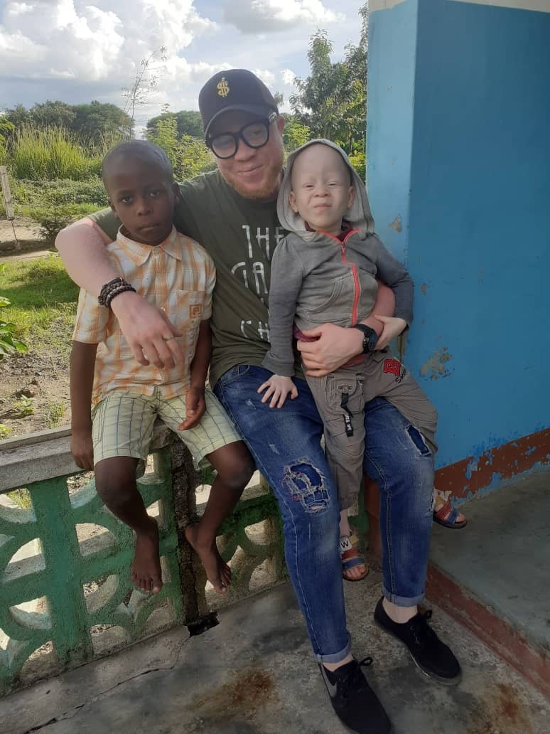 International Albinism Awareness Day 2021 - Campaign