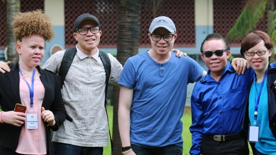 International Albinism Awareness Day 2021 - Campaign