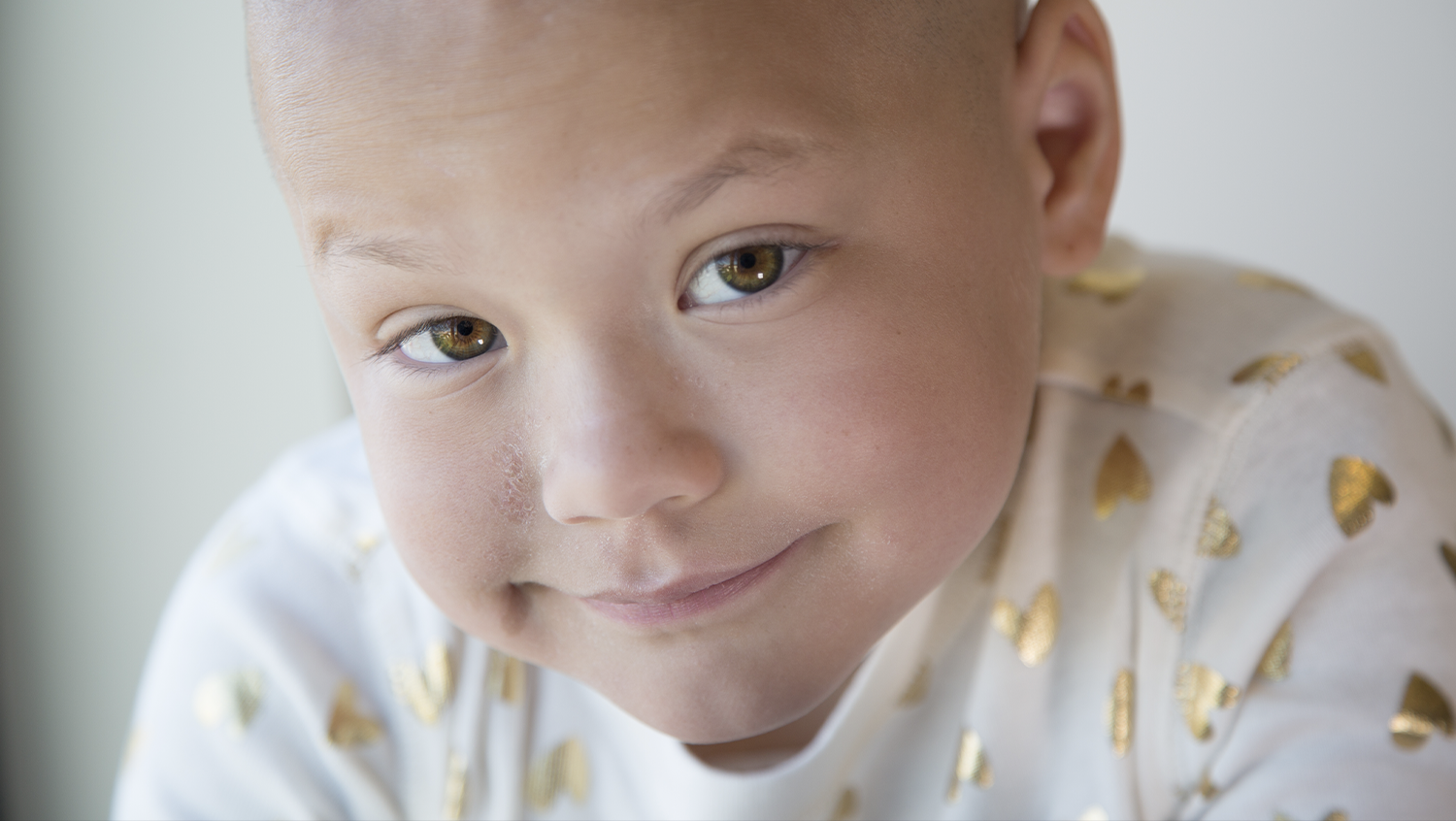 Amazon CVG 9 GO GOLD® - Campaign